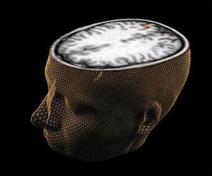 Modern scanners bring mind reading step closer | Health News - The ...