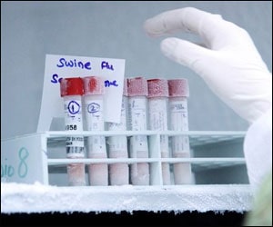 Swine flu vaccine could be available within weeks | Health News - The ...