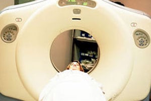 CT scans increase cancer risk | Health News - The Indian Express