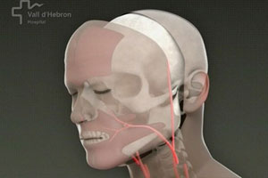 Surgeons complete world’s first full-face transplant | Health News ...