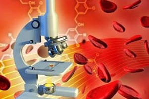 Now,a 5-min test to detect bowel cancer! | Health News - The Indian Express