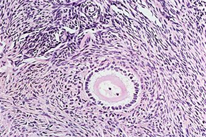 First artificial human ovary created. | Health News - The Indian Express