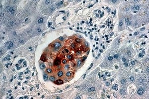 Gene behind muscle disease discovered | Health News - The Indian Express