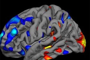 Zapping the brain can improve your spatial memory | Health News - The ...