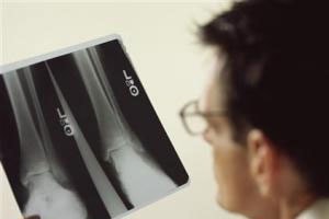 ‘X-ray hazards for obese people’ | Health News - The Indian Express