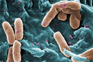 Skin bacteria can protect against infections: study | Health News - The ...