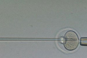 IVF can increase the risk of birth defects: study | Health News - The ...