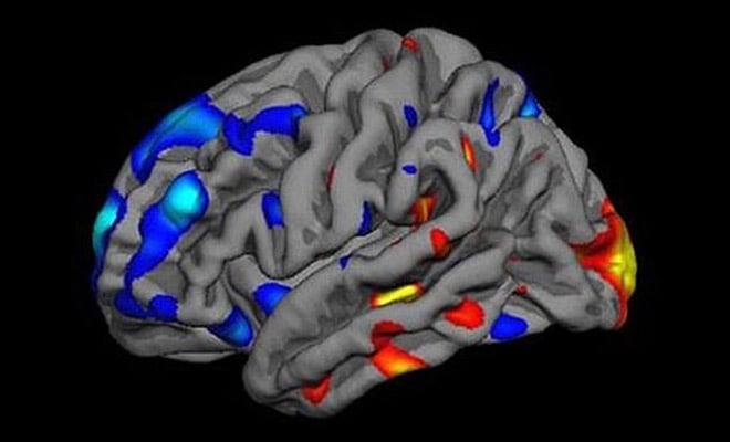 New laser technology to improve accuracy of brain tumour surgery ...