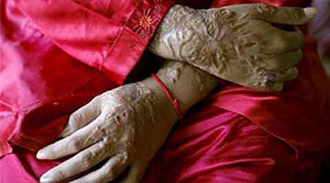309 acid attack cases in ’14, 300% rise in 3 yrs | India News, The ...