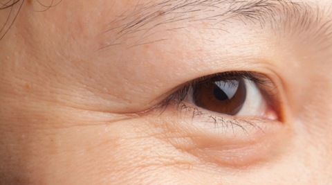 All about wrinkles and what to look for in an anti-wrinkle cream ...