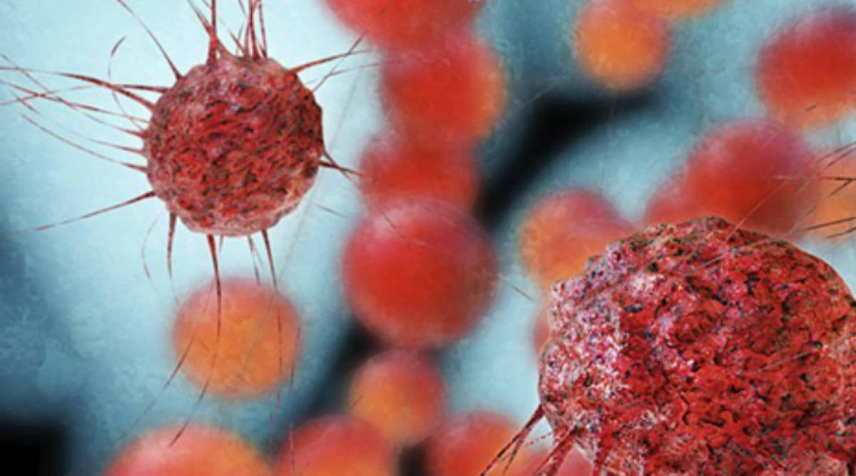 Indian researcher develops 5D ultrasound system to detect cancer ...