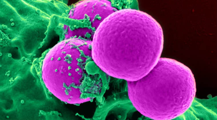 NASA to send superbug to space to help understand its mutation to ...