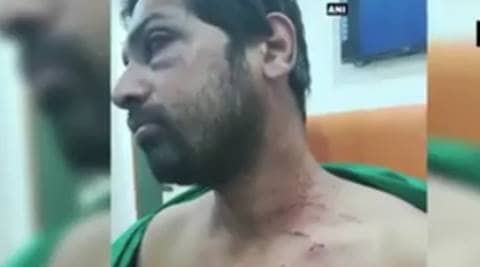 Dhule doctor beaten up by patient’s relatives, admitted in hospital ...