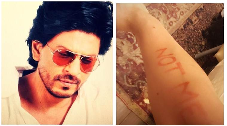 Shah Rukh Khan has another shoulder surgery but keeps his wit intact ...