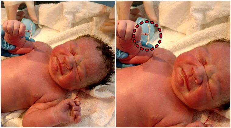 Whoa! Baby holding his mom’s contraceptive device goes viral, but was ...