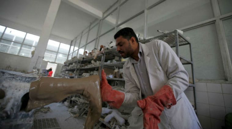 New technique to make prosthetic limbs feel more natural | Technology ...