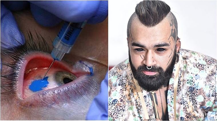 Delhi man is first to get eyeballs tattooed but be careful if you want ...