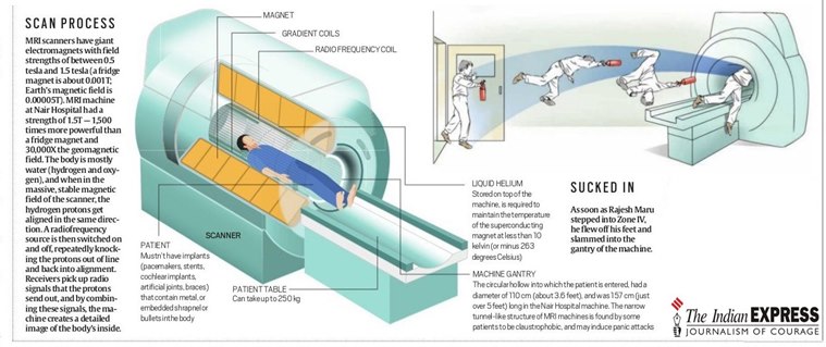 Story of an extraordinary death: How MRI machines work, and can (in ...