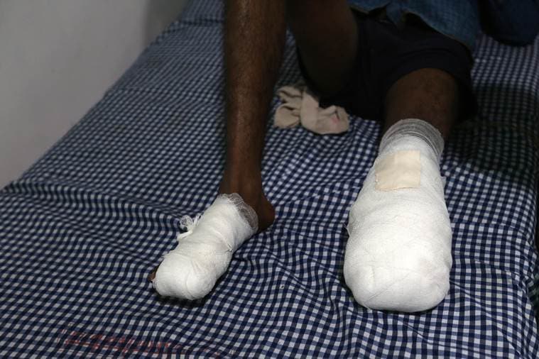 Severed leg used as prop in Uttar Pradesh hospital, no one saw who did ...