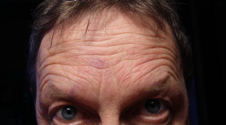 Deep forehead wrinkles may signal heart disease risk | Health News ...