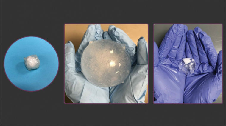 Squishy, expanding pill can monitor stomach cancer, ulcers | Technology ...