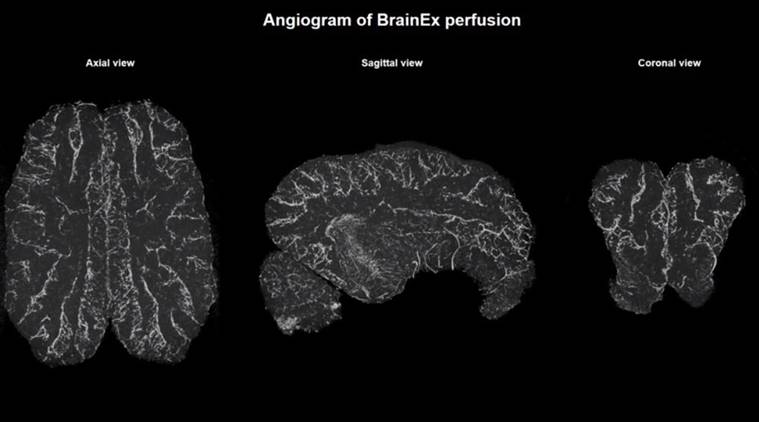 Scientists spur some activity in slaughtered pigs’ brains — research ...