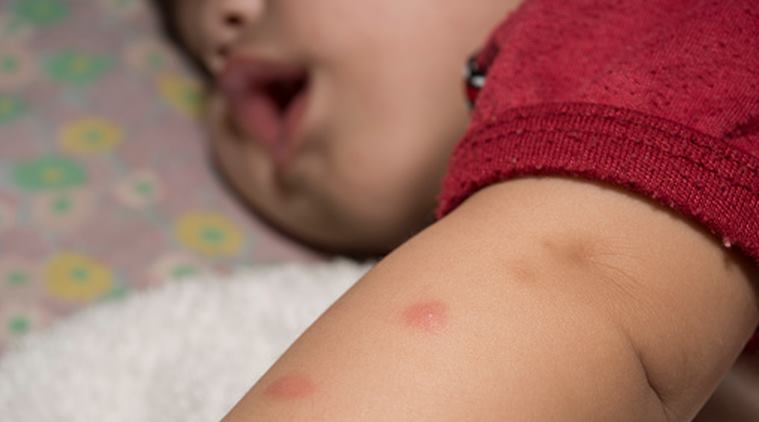 How to protect babies from mosquitoes: Simple daily steps