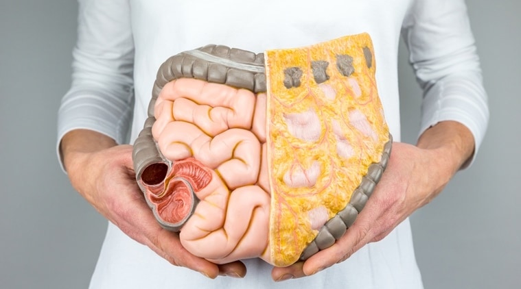 Colon infection: Everything you need to know about it | Health News ...