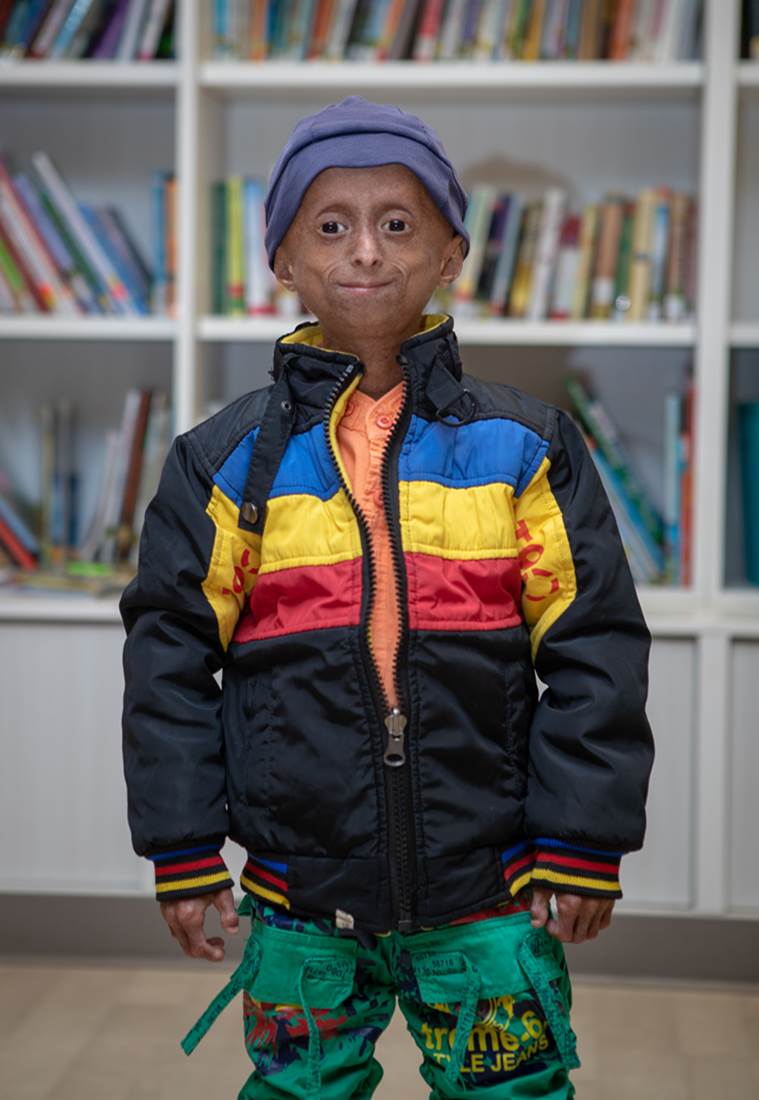 Children with progeria hold out messages of hope in lockdown ...