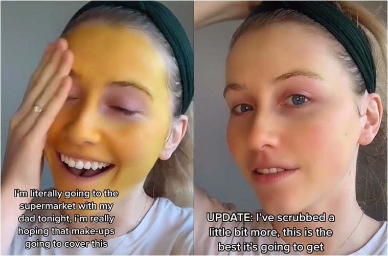 A DIY face mask turns woman’s face yellow, netizens in splits ...