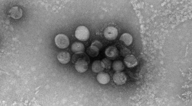 Latest coronavirus in dogs highlights need to search for viruses that ...