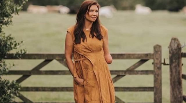 Disabled model reportedly told to ‘move on’ during casting call for ...