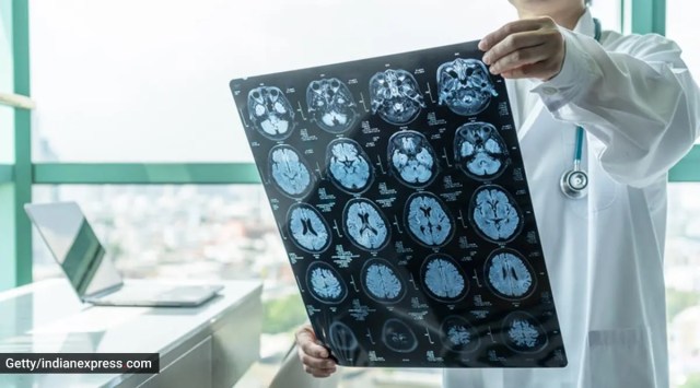 Tourette Syndrome: Know all about this condition of the nervous system ...
