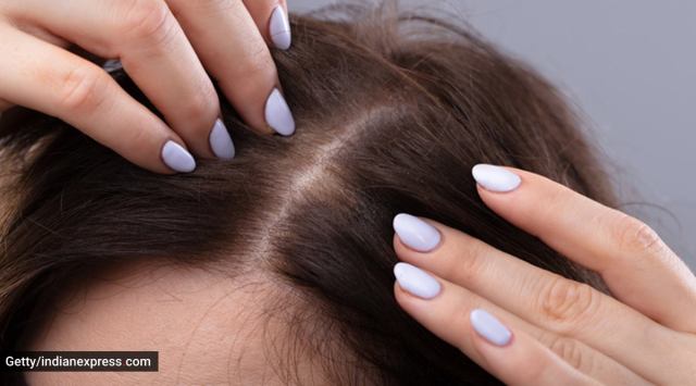 Facing hair thinning issues? Here’s what you can do to remedy the ...