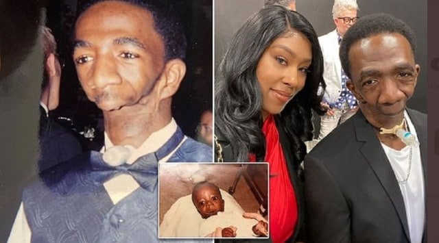 Man born without a jaw on living with Otofocial syndrome; know about ...