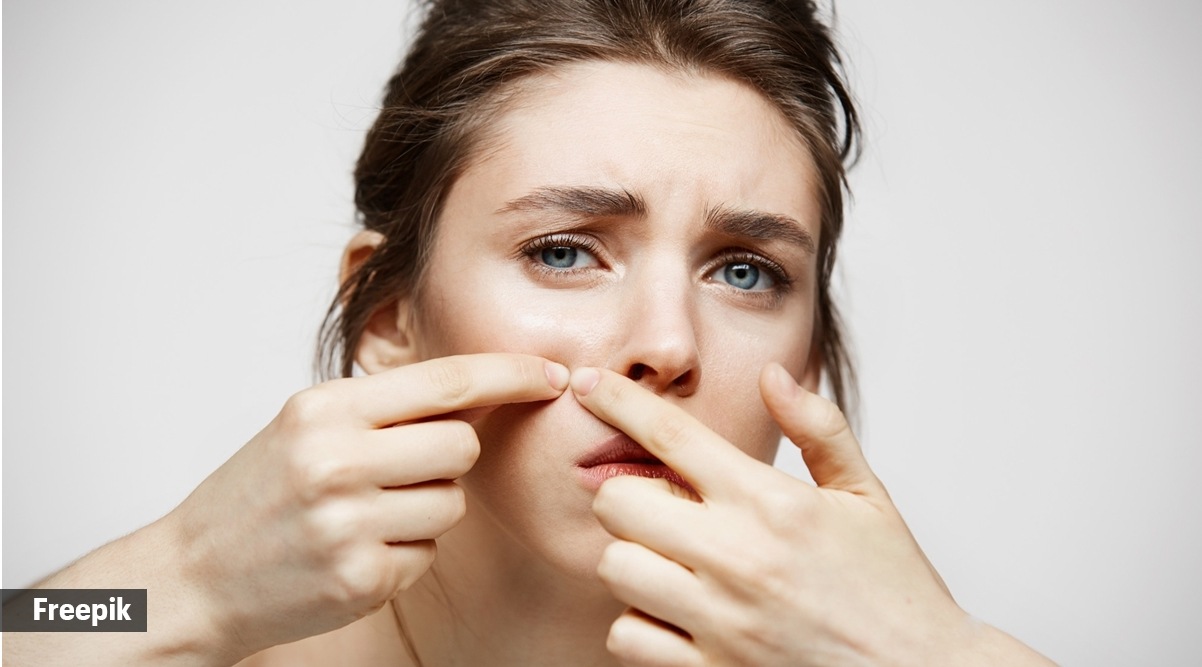 Follow these tips to treat different types of acne | Life-style News ...
