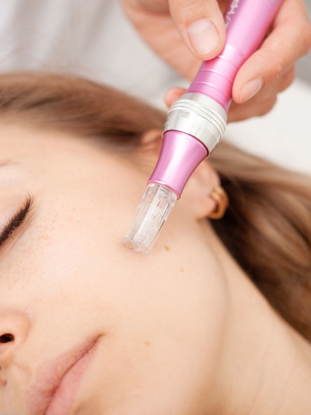 Disadvantages of vampire facial | The Indian Express