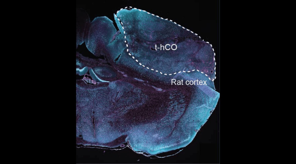 Human brain cells transplanted in rats to study diseases | World News ...