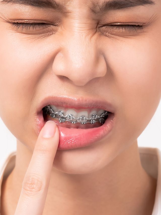 Ayurvedic remedies for dental pain | The Indian Express