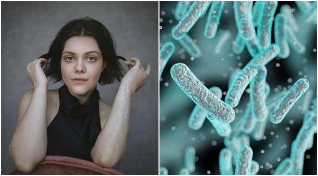 The Chronicles of Narnia actor Georgie Henley on being diagnosed with ...