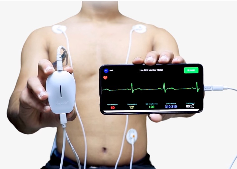 Loss of friend inspires Dehradun techie to develop portable ECG device ...