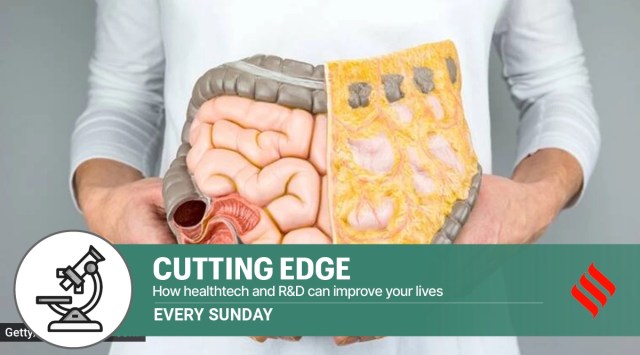 AI tool screens cancer during colonoscopy and removes growth at an ...