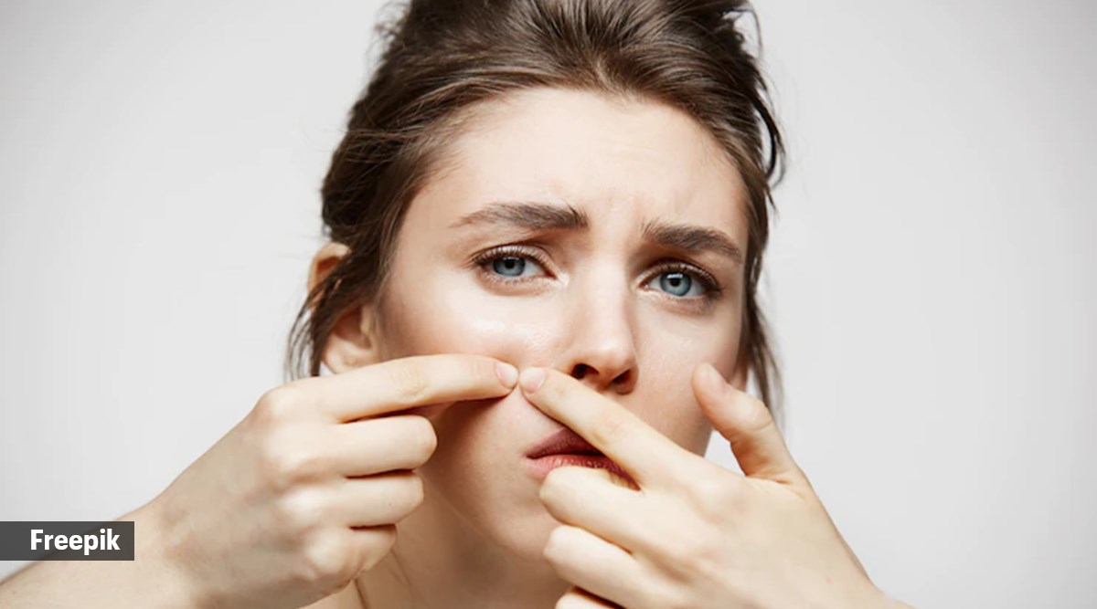 Five acne myths you should stop believing | Life-style News - The ...