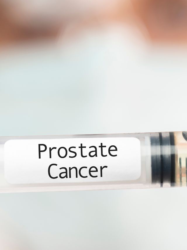 Prostate cancer treatment can wait for most men | The Indian Express