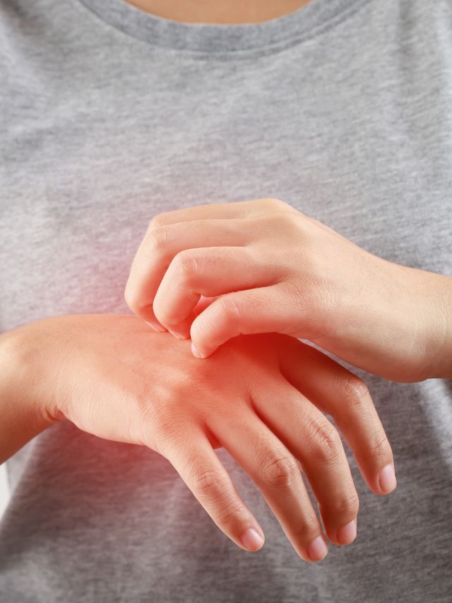 What is exercise-induced urticaria? | The Indian Express