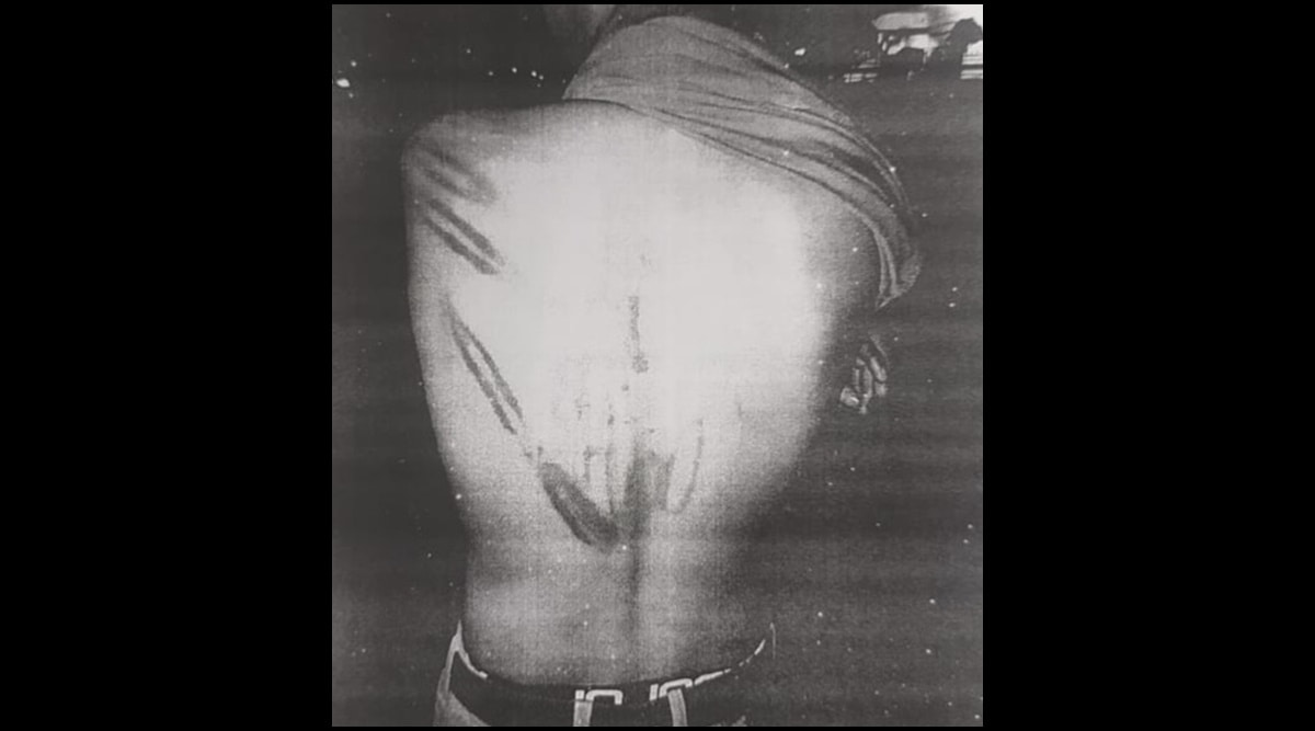 Restaurant staff allege illegal custody, torture; Chandigarh court asks ...