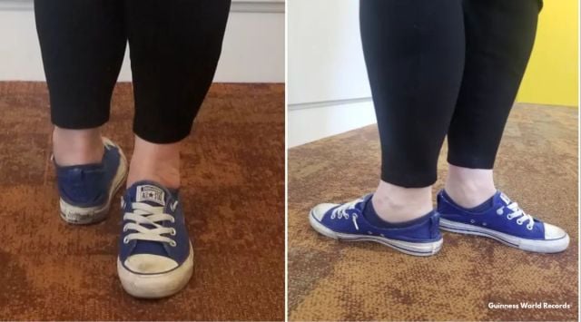 US woman rotates her feet back to front, breaks world record | Trending ...