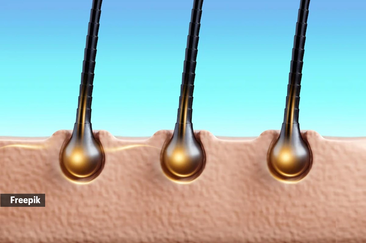 All about sebaceous filaments: What they are and how to reduce them ...