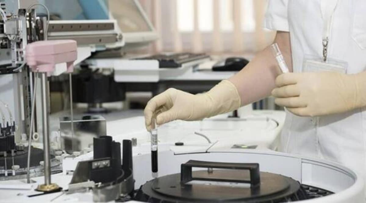Pune’s Mylab receives approval for herpes virus RT-PCR detection kit ...