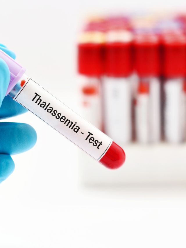 What is Thalassemia? | The Indian Express